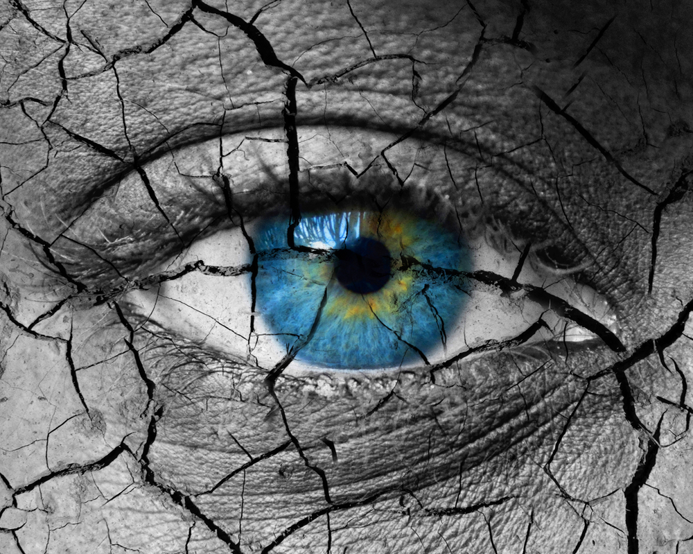 What is the Success Rate of LipiFlow? | Dr. Ramsarat